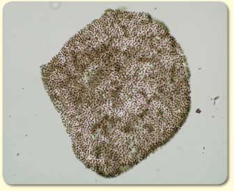 ミクロキスティス イクチオブラーベ